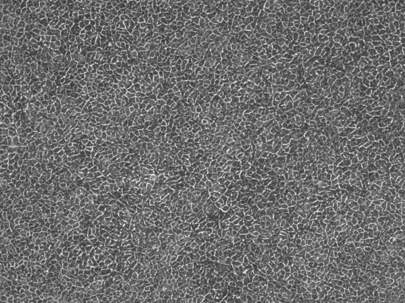 Small Airway Epithelial Cell Model | Newcells Biotech